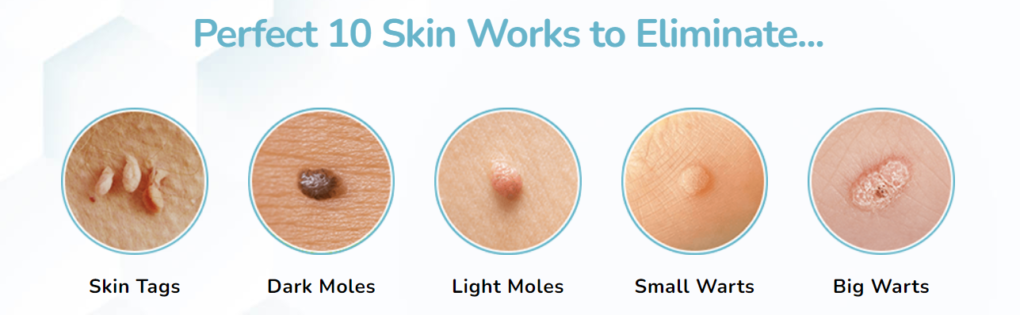 Mole & Skin Tag Remover That Naturally Eliminates In 8 Hours Biggest ...